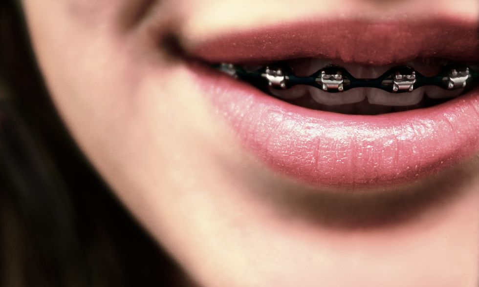 It’s not that your teeth are too big — your jaw is too small - Alternet.org